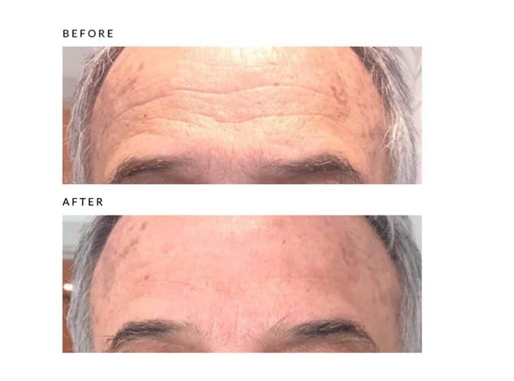 Salt Facial in Seattle, WA - Seattle Beauty