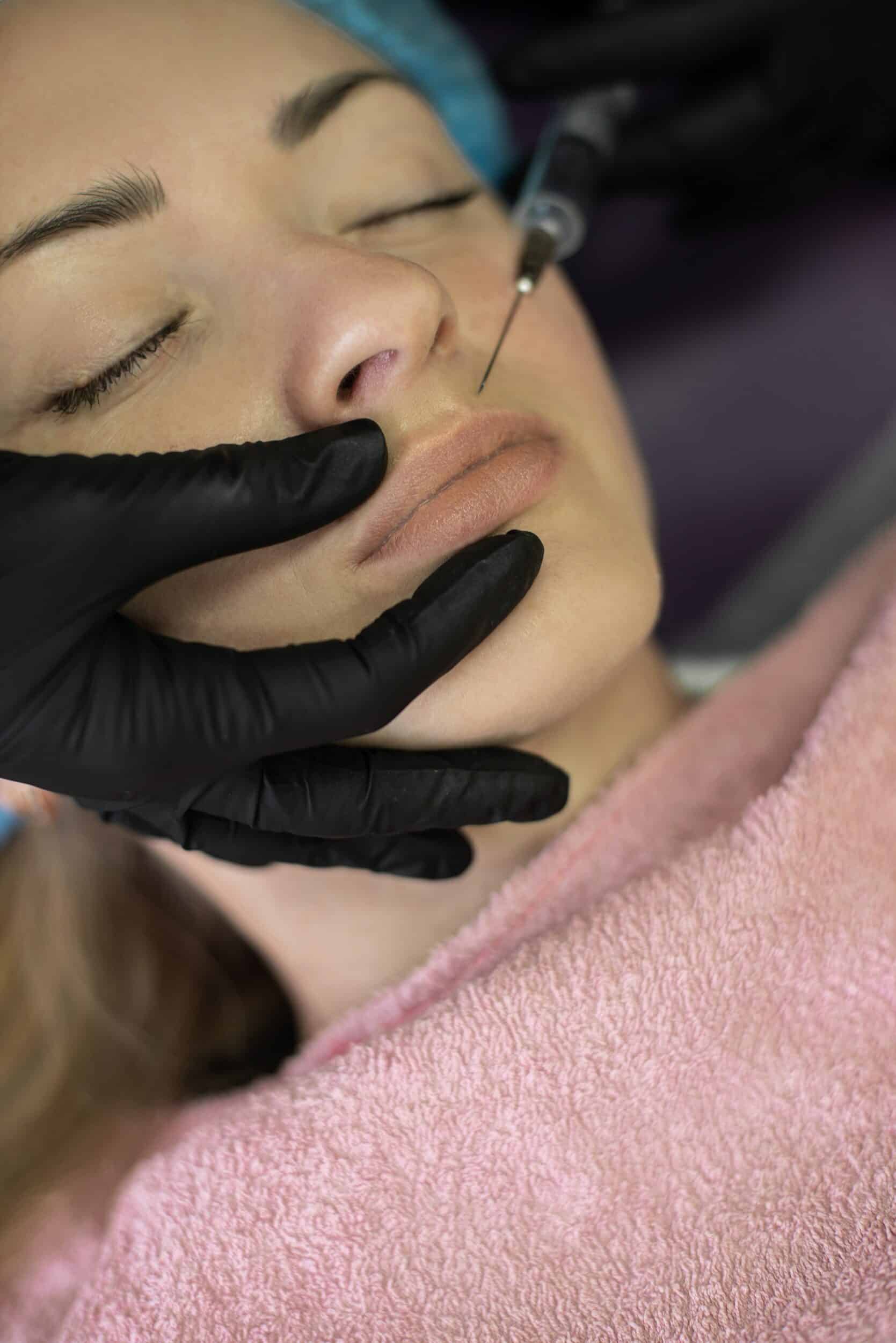 How Dermal Fillers Can Help You Feel & Look More Youthful